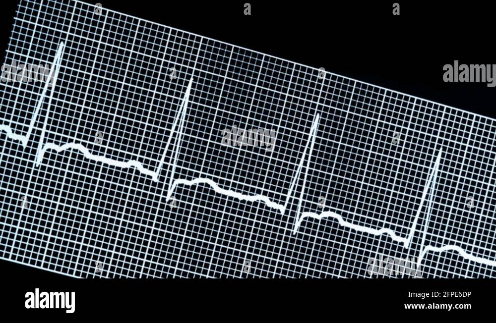 Ekg strip Stock Videos & Footage - HD and 4K Video Clips - Alamy