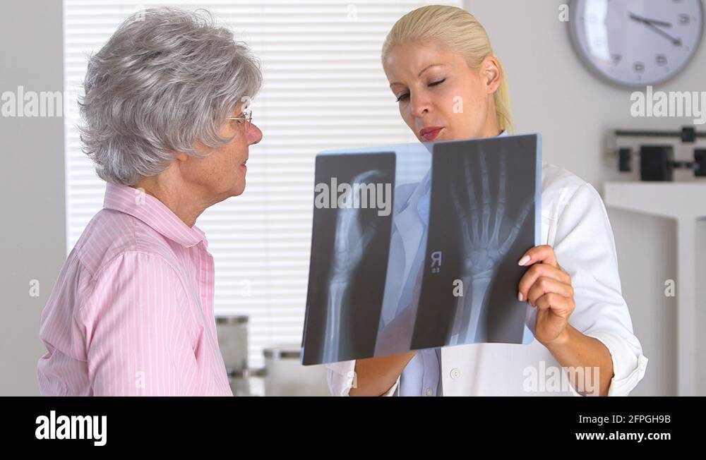 Bone Age X Ray Stock Videos And Footage Hd And 4k Video Clips Alamy
