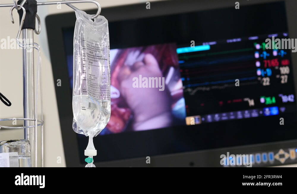 Intravenous monitoring system Stock Videos & Footage - HD and 4K Video ...