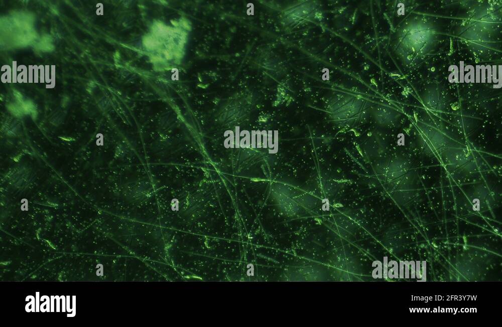 Nematode worms Stock Videos & Footage - HD and 4K Video Clips - Alamy