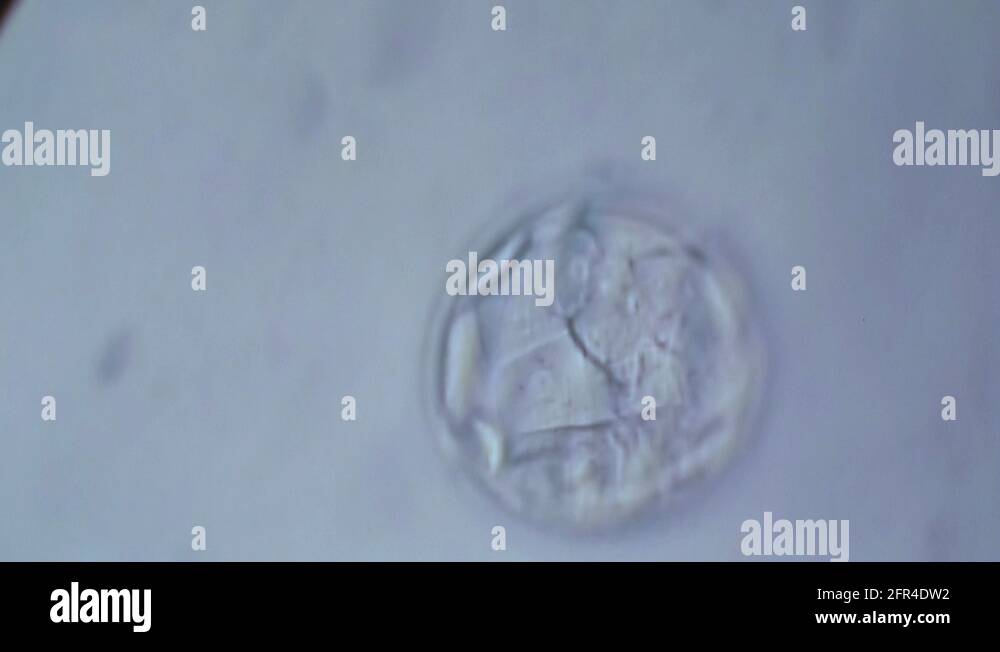 Cellular division of an in vitro fetus under microscope. Generic cell ...