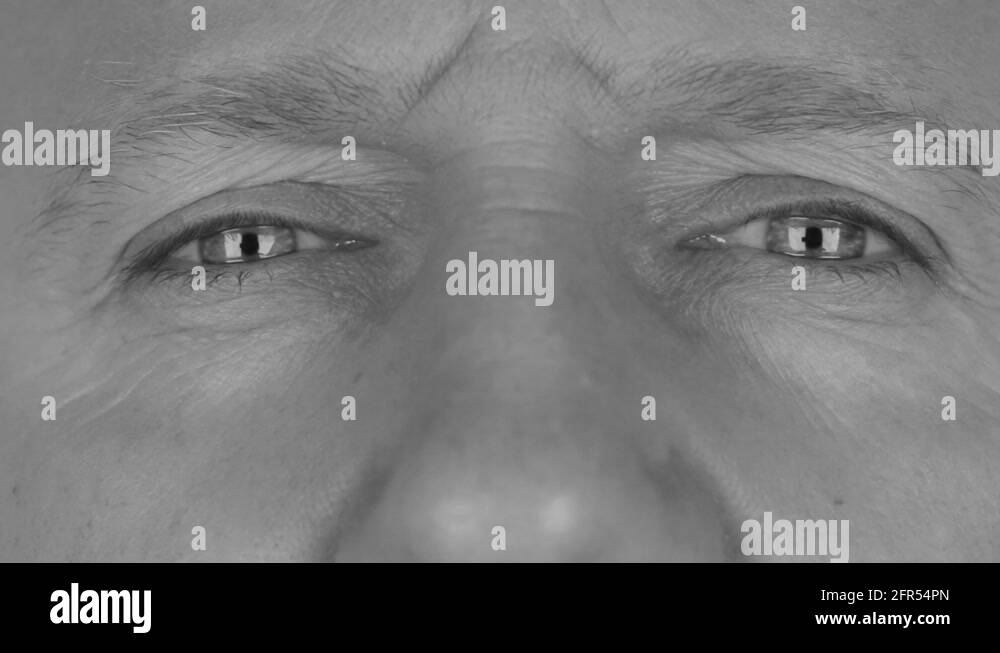 Popped eye Stock Videos & Footage - HD and 4K Video Clips - Alamy