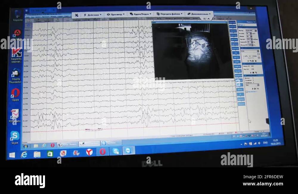 Neuroscope Stock Videos & Footage - HD and 4K Video Clips - Alamy