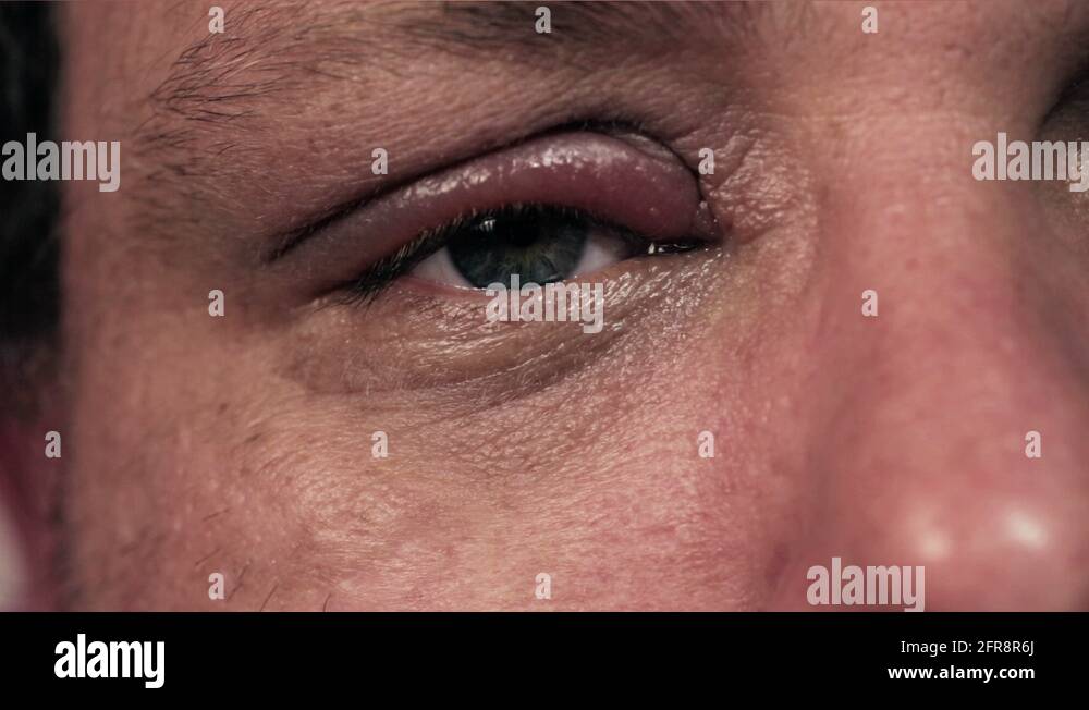 Flinching Stock Videos & Footage - HD and 4K Video Clips - Alamy