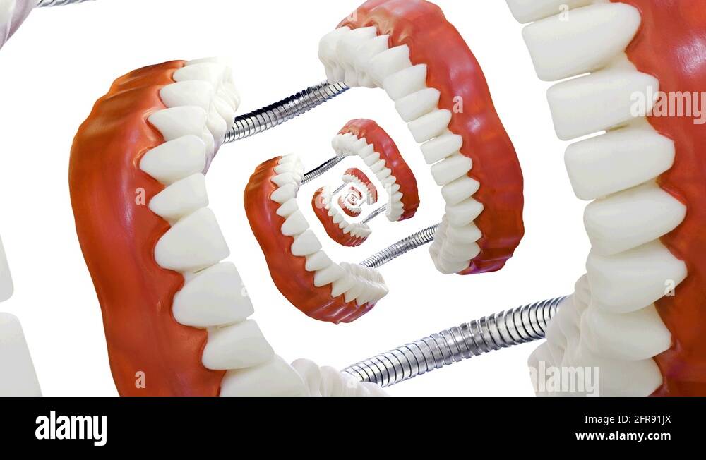Denture dentures Stock Videos & Footage - HD and 4K Video Clips - Alamy