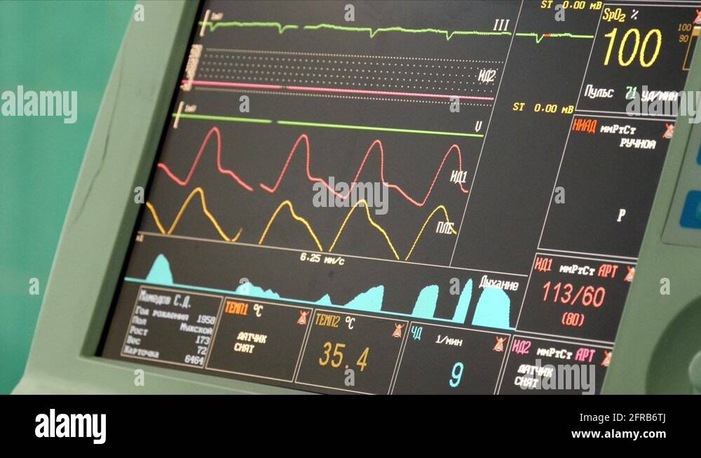 Medical monitor computer with indications of human heart activity Stock ...