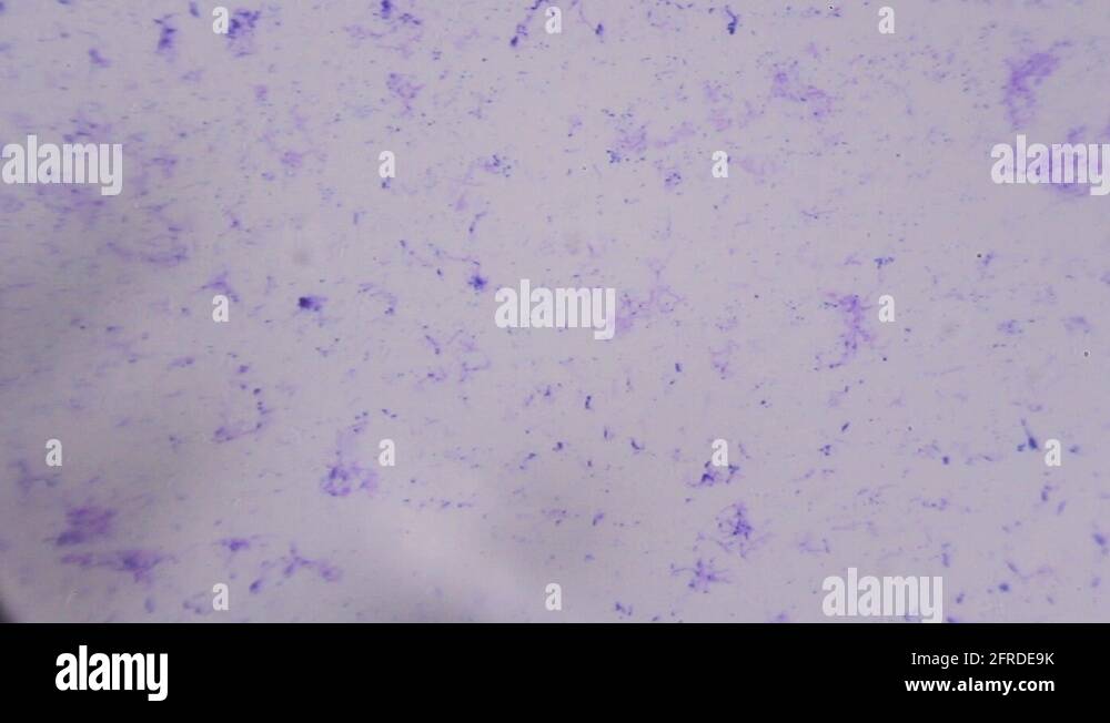 Nerve tissue under microscope Stock Videos & Footage - HD and 4K Video ...