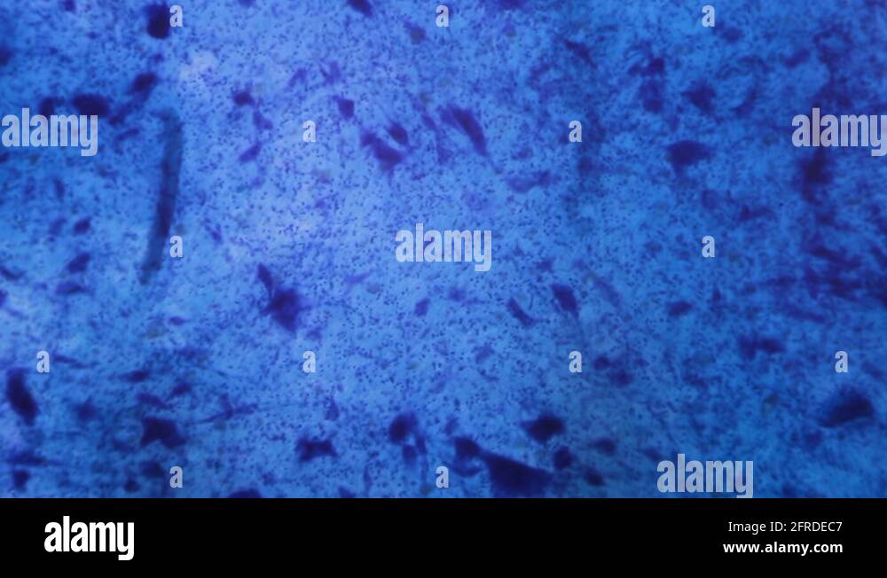 Nerve cell under the microscope - Abstract blue dots on white ...