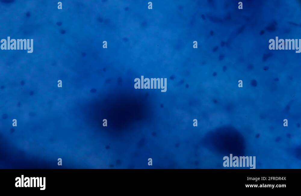 Nerve cell under the microscope - Abstract blue dots on white ...