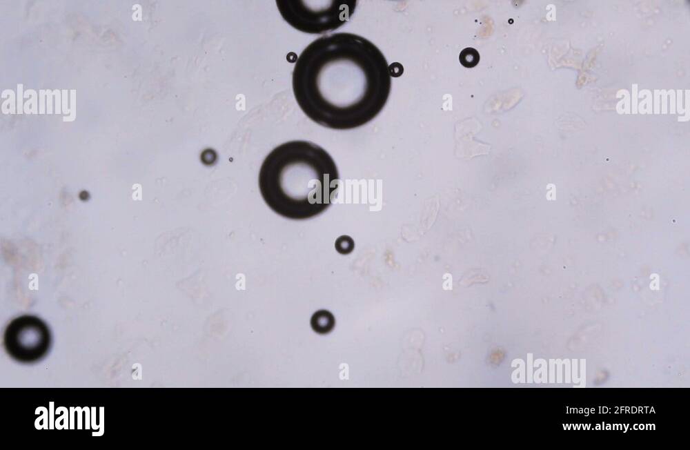 Water bubbles under the microscope Stock Video Footage - Alamy