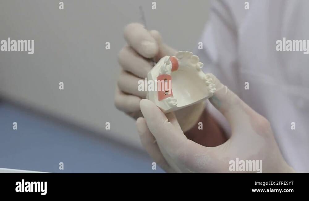 Prosthetic jaw Stock Videos & Footage - HD and 4K Video Clips - Alamy