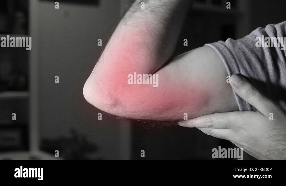 Elbow joint anatomy Stock Videos & Footage - HD and 4K Video Clips - Alamy