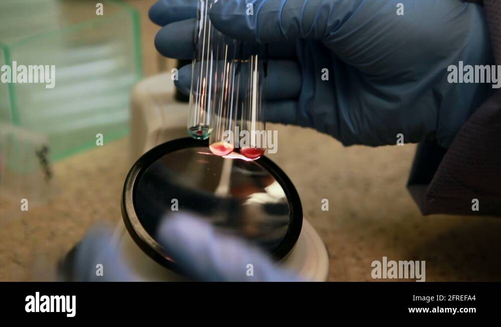 Blood drug testing Stock Videos & Footage - HD and 4K Video Clips - Alamy