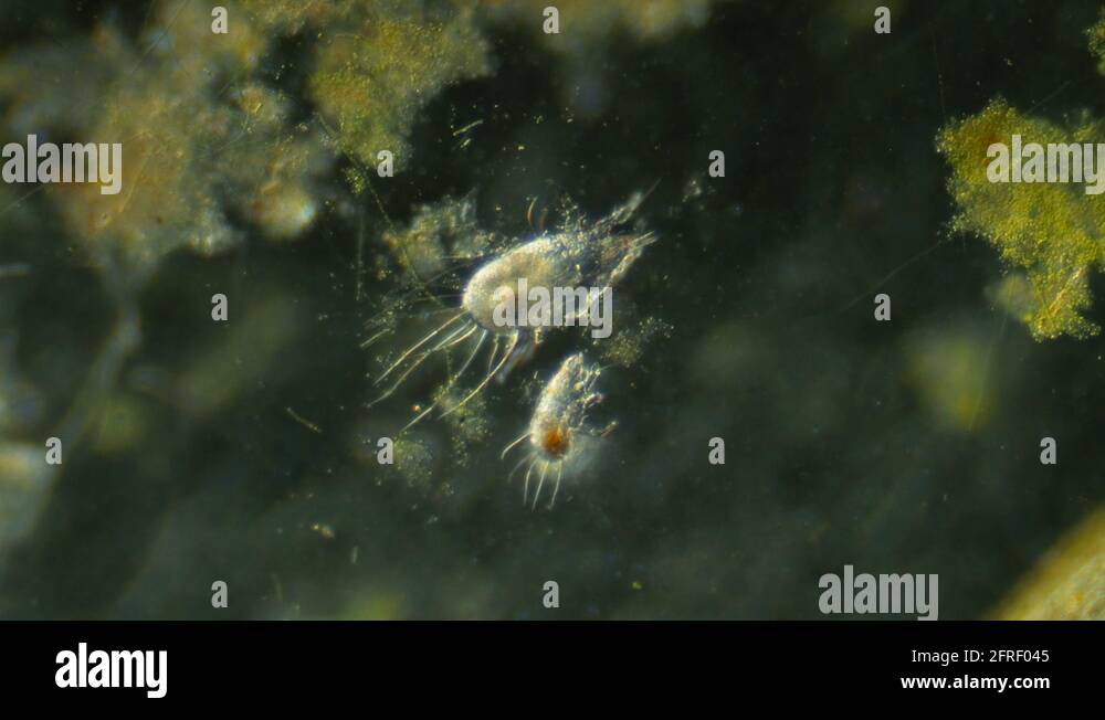 Acari Mites Tangled in Saple, Dark Field Microscope 100x Stock Video ...