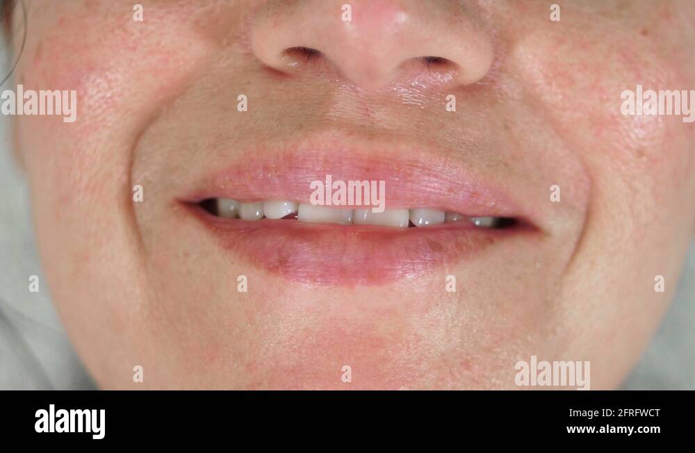 Dental Patient Female Xray Smile Stock Video Footage - Alamy