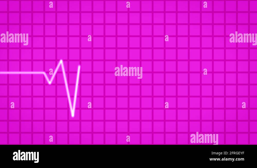 Electrocardiogram ekg Stock Videos & Footage - HD and 4K Video Clips ...