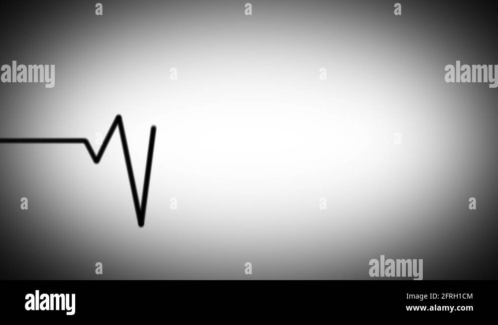 electrocardiogram (EKG or ECG) black and white loop Stock Video Footage ...