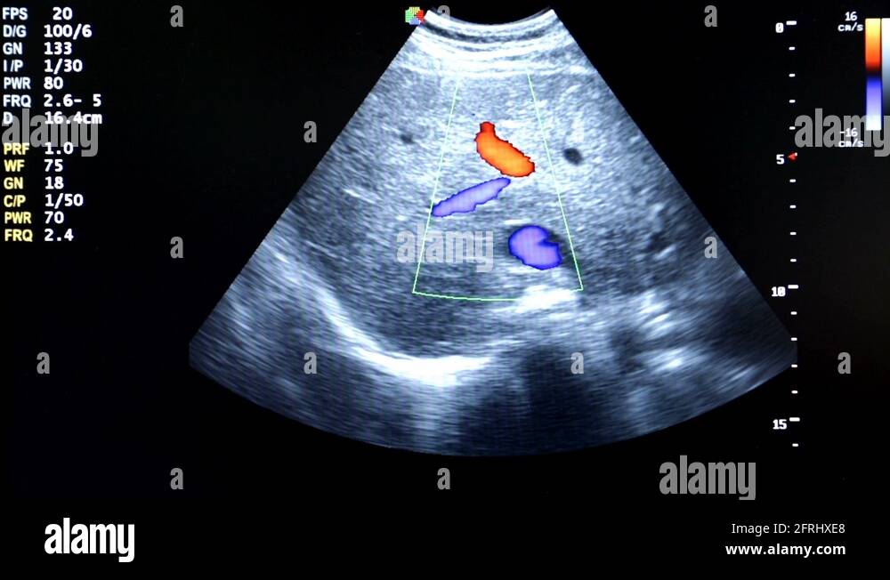 Cardiac ultrasound Stock Videos & Footage - HD and 4K Video Clips - Alamy