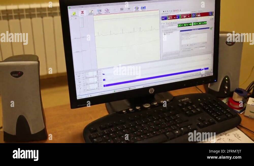 Muscle structure Stock Videos & Footage - HD and 4K Video Clips - Alamy