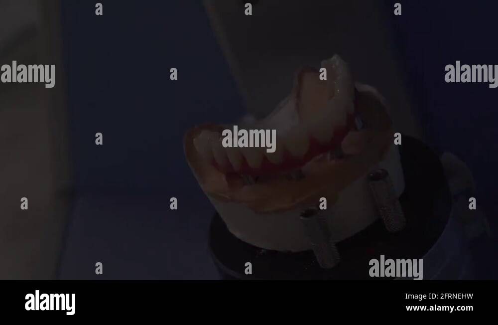 Dental prosthetic restoration Stock Videos & Footage - HD and 4K Video ...