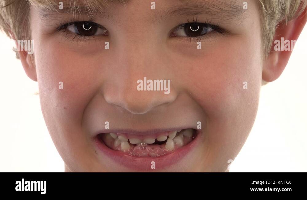 Boy missing teeth Stock Videos & Footage - HD and 4K Video Clips - Alamy