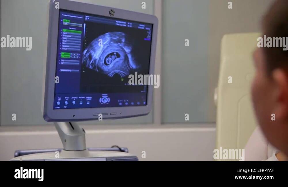 Medical ultrasound scan of human embryo Stock Video Footage - Alamy