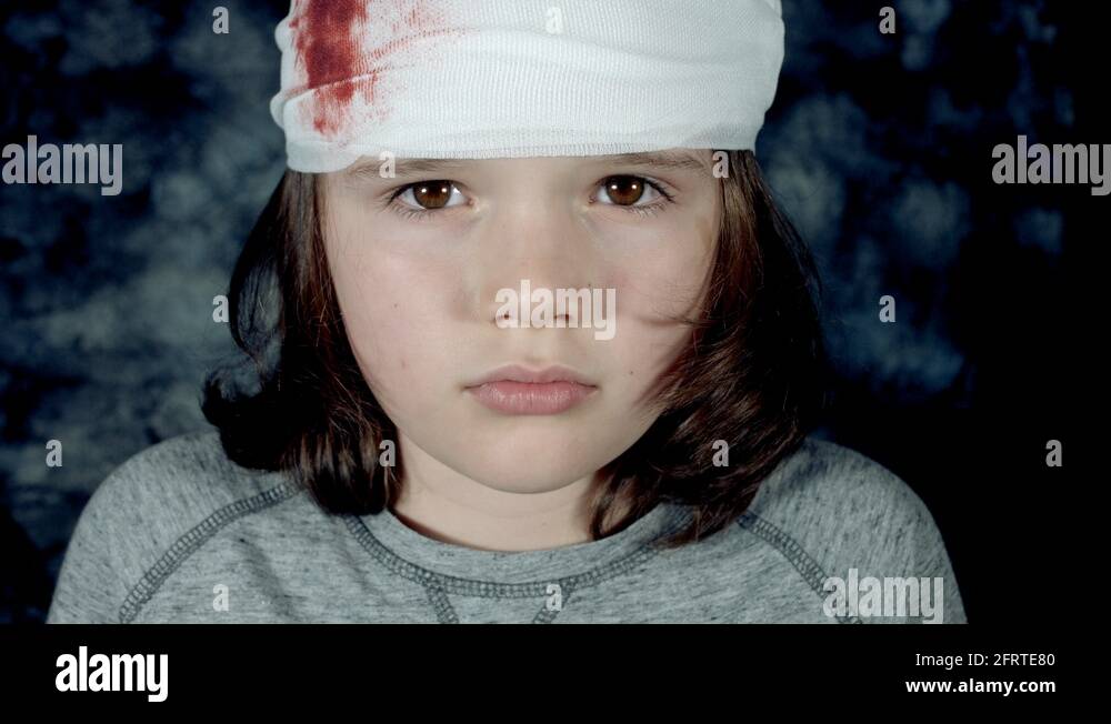 Injured bleeding head Stock Videos & Footage - HD and 4K Video Clips ...