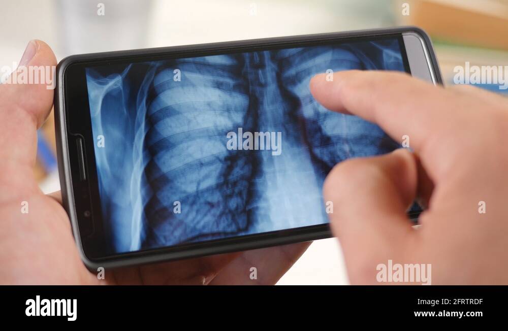 Xray radiography Stock Videos & Footage - HD and 4K Video Clips - Alamy