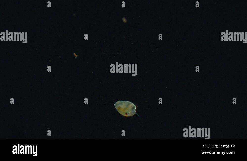 Dark field microscopy cells Stock Videos & Footage - HD and 4K Video ...