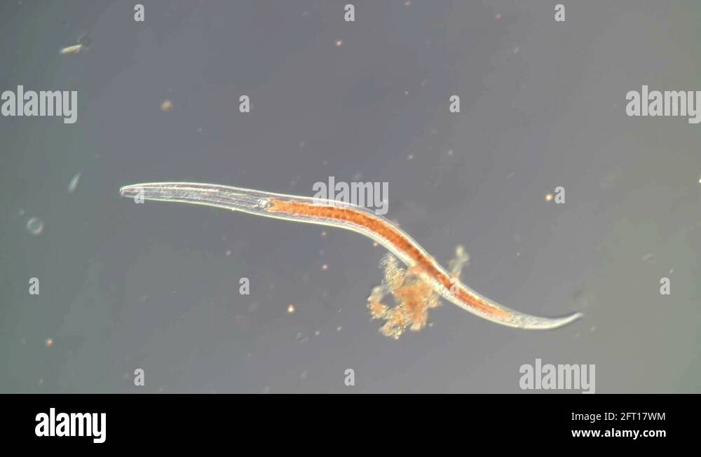 Nematode microscope Stock Videos & Footage - HD and 4K Video Clips - Alamy