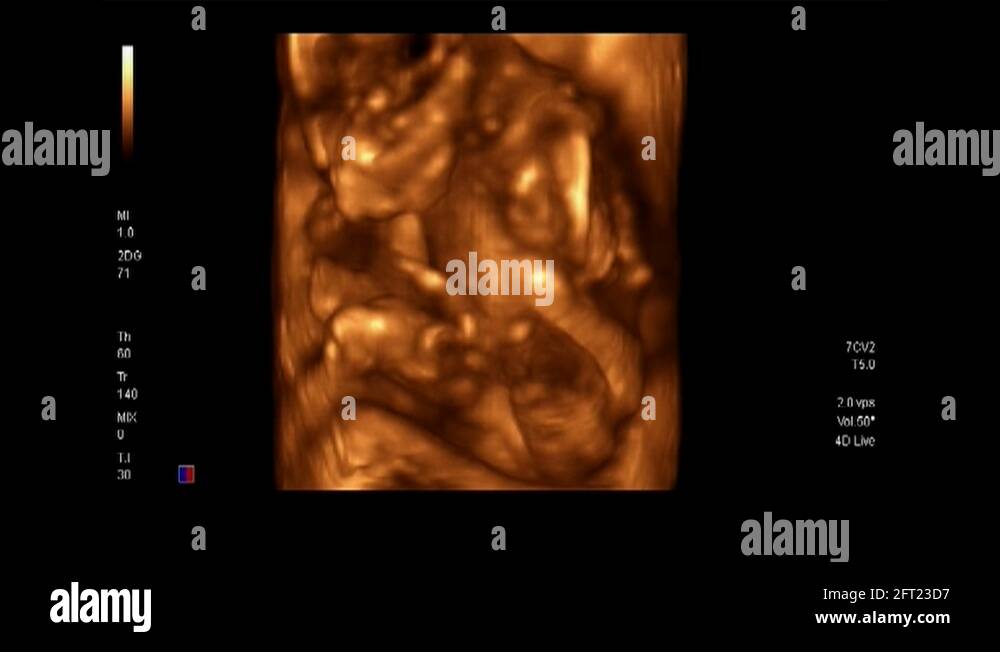 Ultrasound body Stock Videos & Footage - HD and 4K Video Clips - Alamy