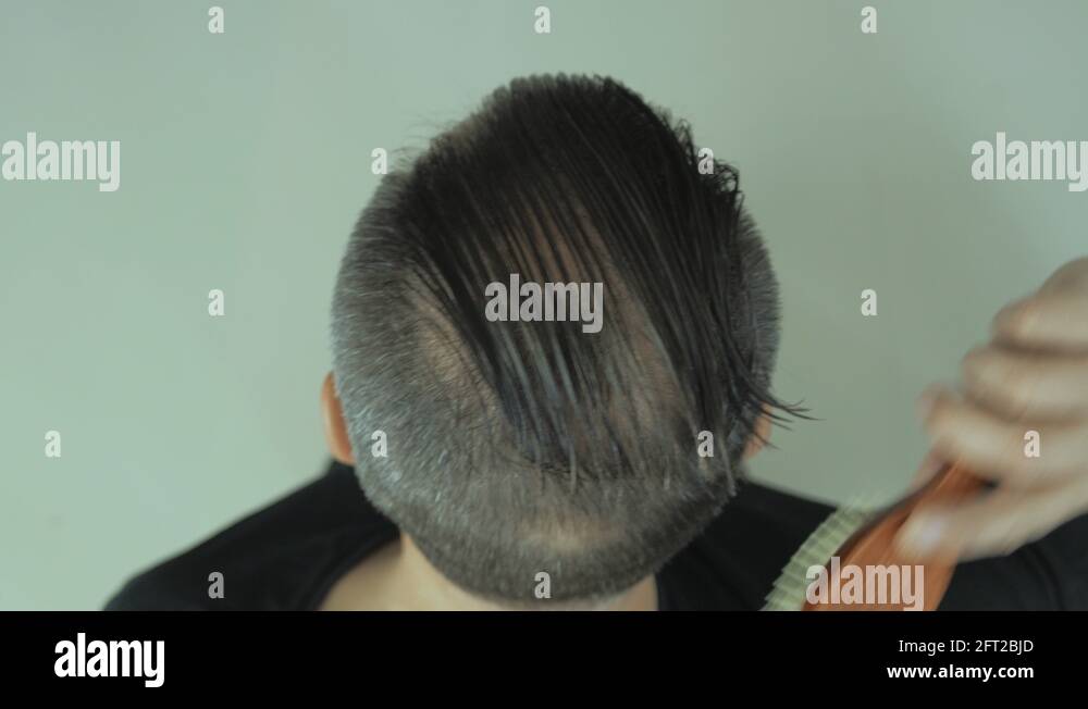 Comb over hair man Stock Videos & Footage - HD and 4K Video Clips - Alamy