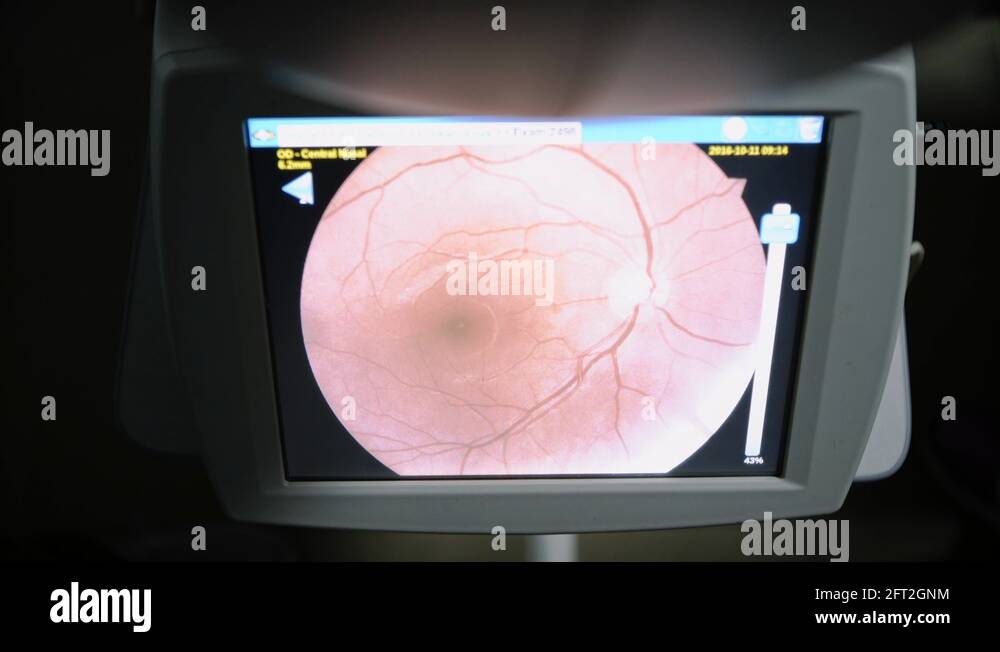 Eye test computer Stock Videos & Footage - HD and 4K Video Clips - Alamy