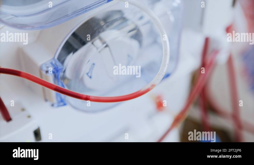 Dialysis filter Stock Videos & Footage - HD and 4K Video Clips - Alamy