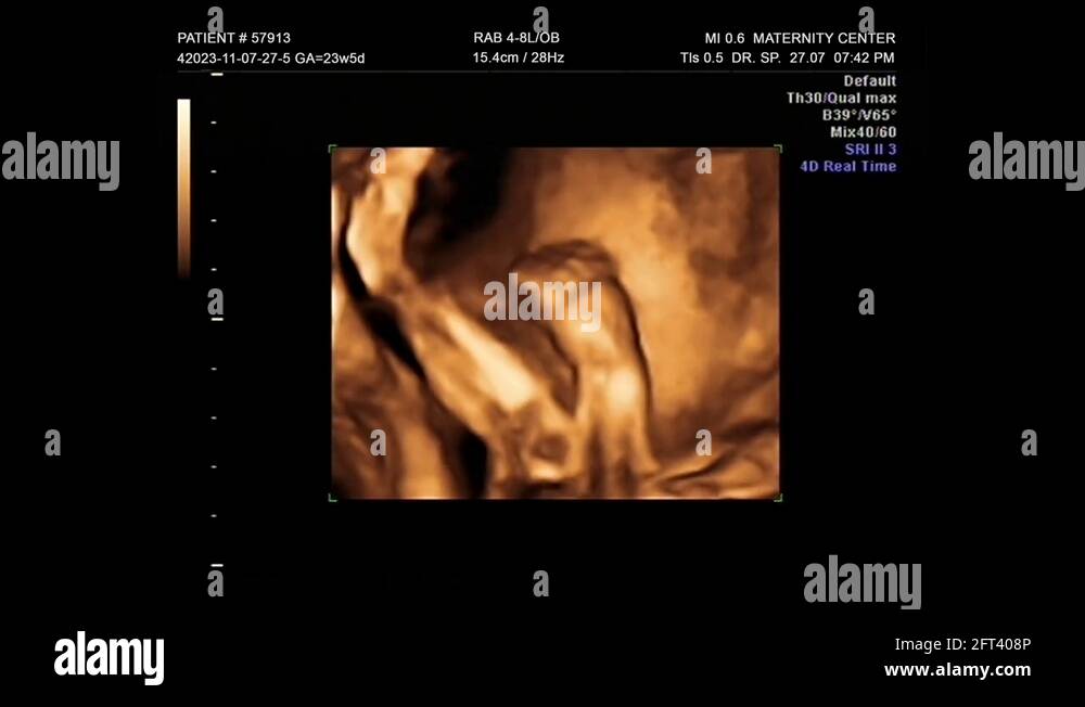 4d baby scan Stock Videos & Footage - HD and 4K Video Clips - Alamy