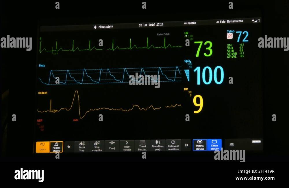 Ecg monitor Stock Videos & Footage - HD and 4K Video Clips - Alamy