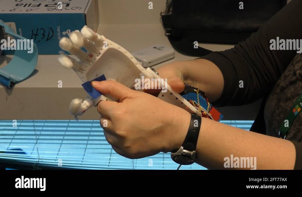A woman demonstrates a 3D printed, bionic hand to the help of amputated ...
