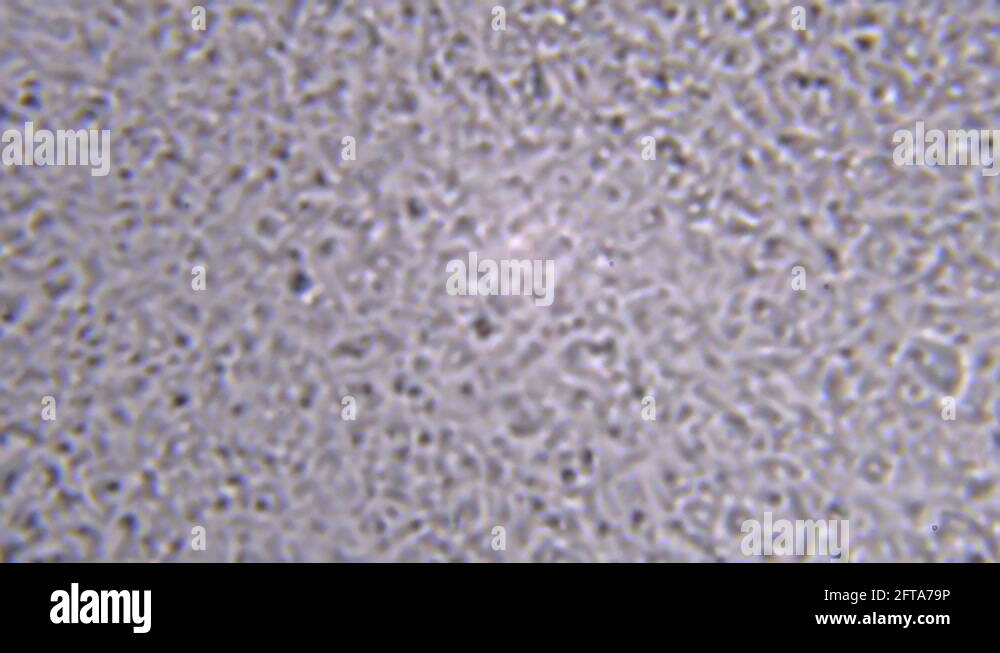 A colony of bacteria under a microscope. Magnification of about 1000x ...