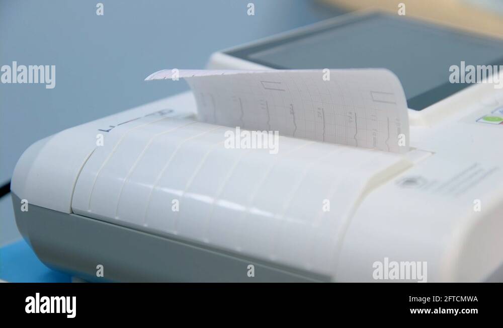 Cardiac output Stock Videos & Footage - HD and 4K Video Clips - Alamy