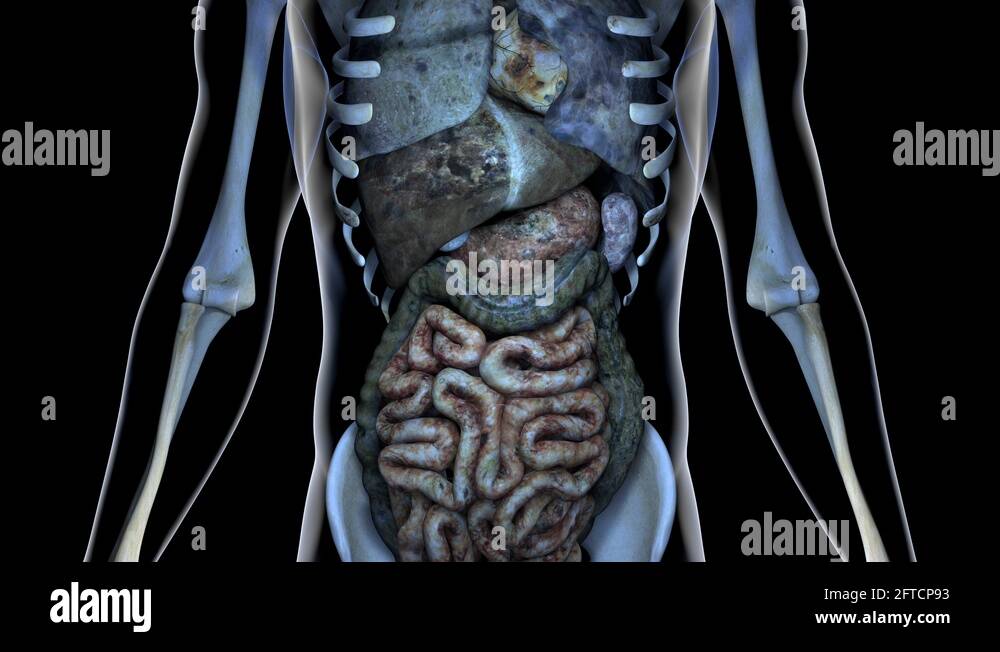 4K Sick Internal Organs in a Transparent Human Body Anatomical 3D ...