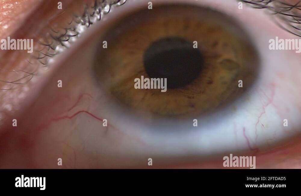 Pupil dilate Stock Videos & Footage - HD and 4K Video Clips - Alamy