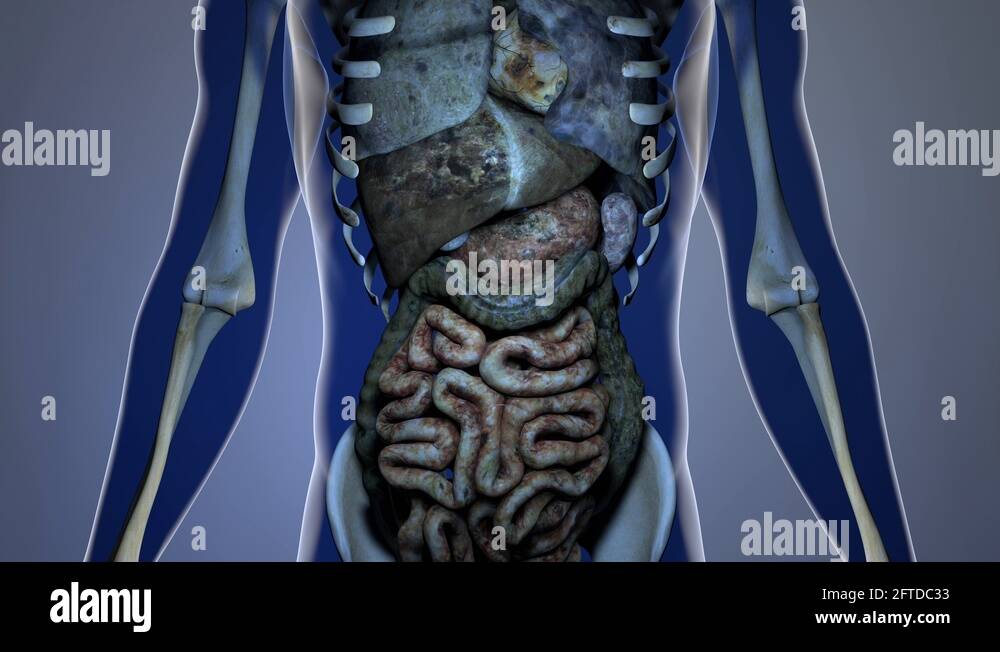 4K Sick Internal Organs in a Transparent Human Body Anatomical 3D ...