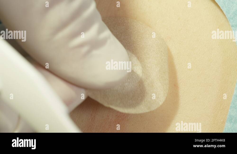 Tissue adhesive plaster Stock Videos & Footage - HD and 4K Video Clips ...