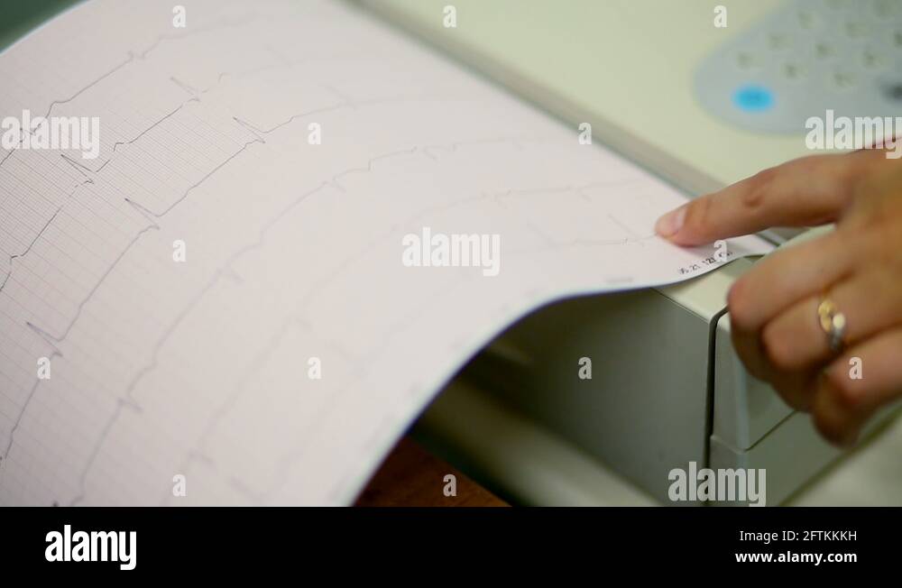 Ecg machine Stock Videos & Footage - HD and 4K Video Clips - Alamy