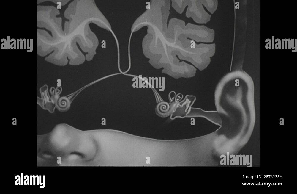 Anatomical diagram brain Stock Videos & Footage - HD and 4K Video Clips ...