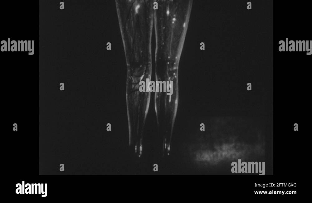 1950s: Radiological view of human body Stock Video Footage - Alamy