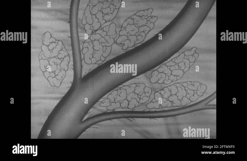 1950s: Illustration of bone growth Stock Video Footage - Alamy
