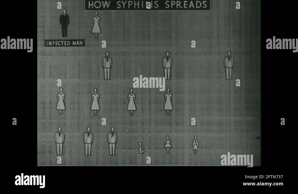 1930s: The spread of syphilis shown through a diagram Stock Video ...