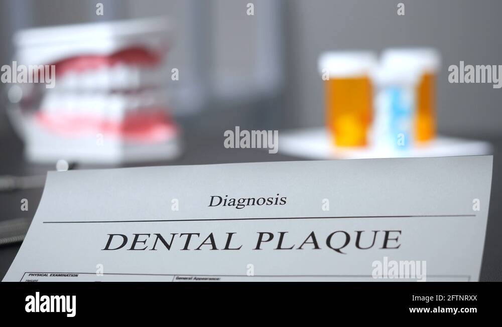 Periodontitis illustration Stock Videos & Footage - HD and 4K Video ...