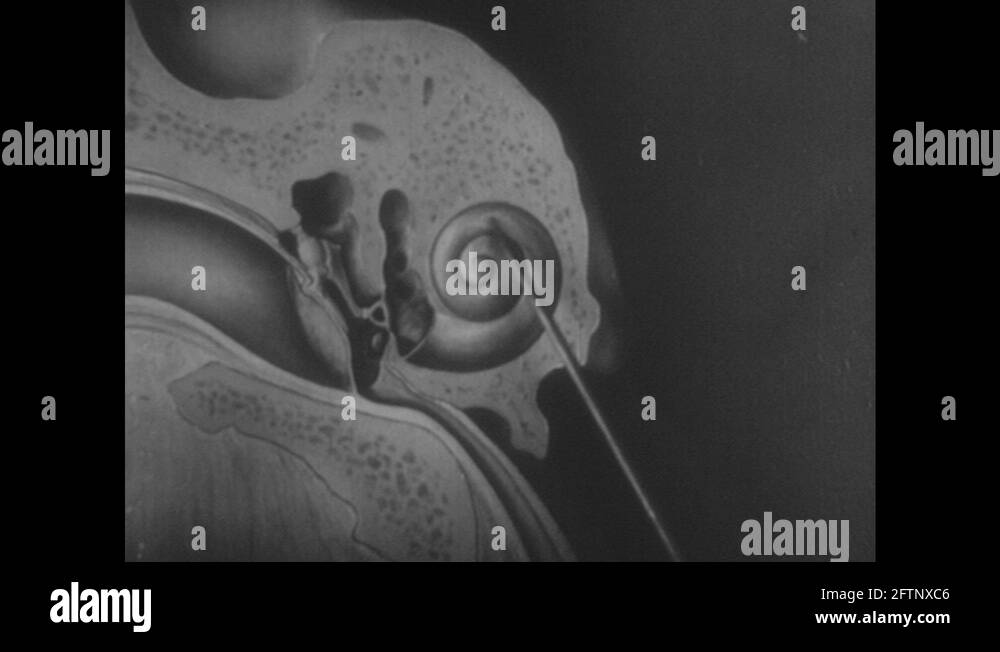 Cochlear anatomy Stock Videos & Footage - HD and 4K Video Clips - Alamy